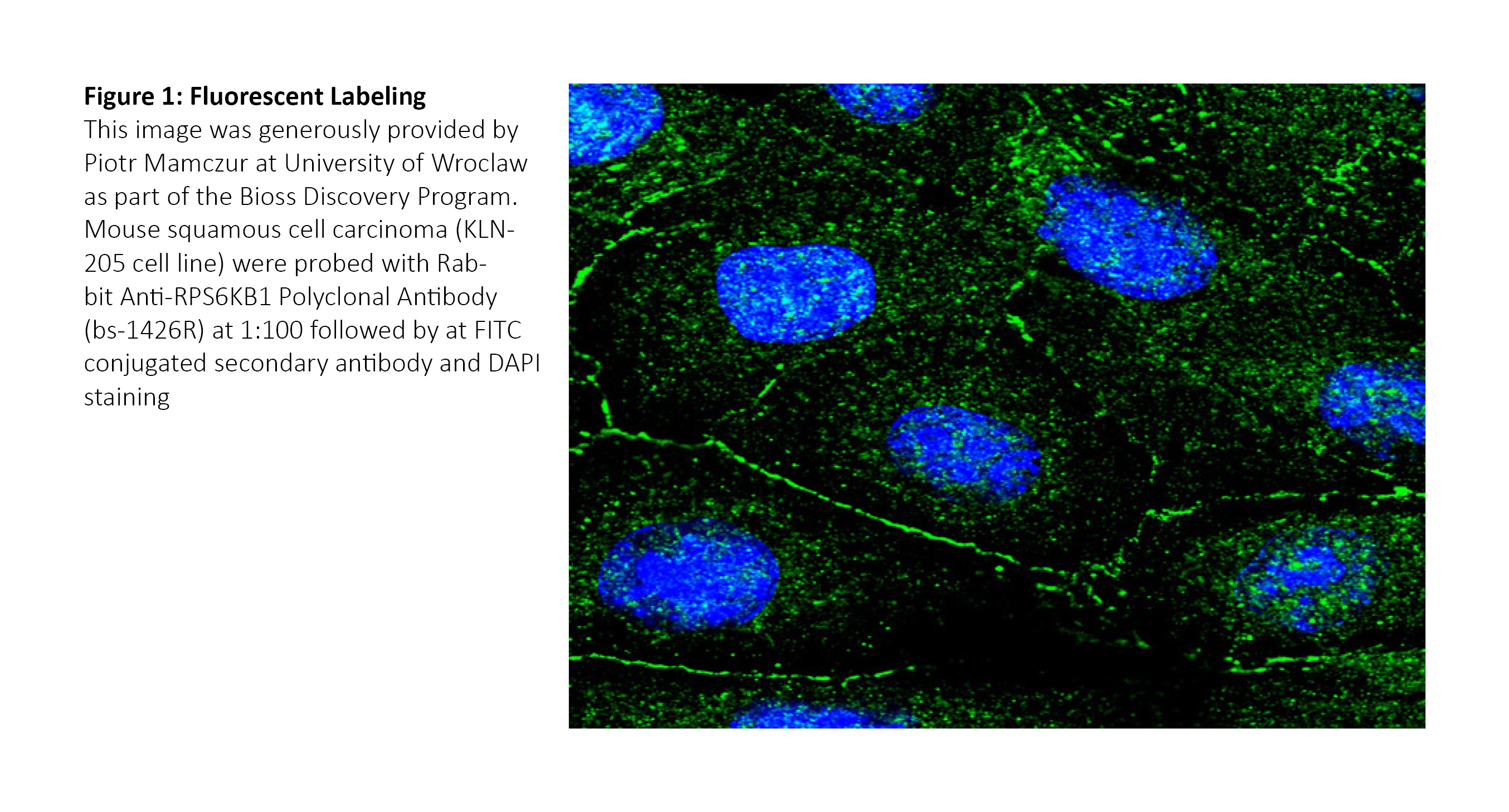 Fluorescent vs. Chromogenic Detection in Immunohistochemistry – Bioss